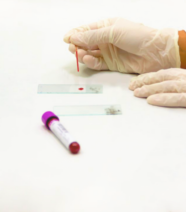 Laboratory Testing Services & Blood Tests Near You | SGD