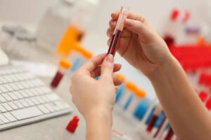 Best Medical Labs for Individual Lab Tests With Results Fast