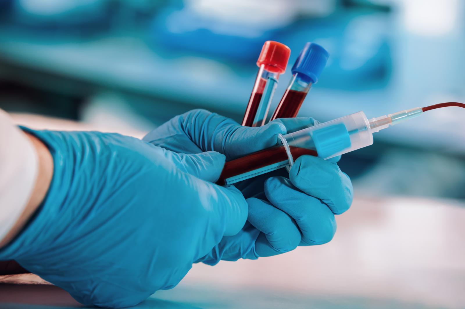 Best Medical Labs for Individual Lab Tests With Results Fast