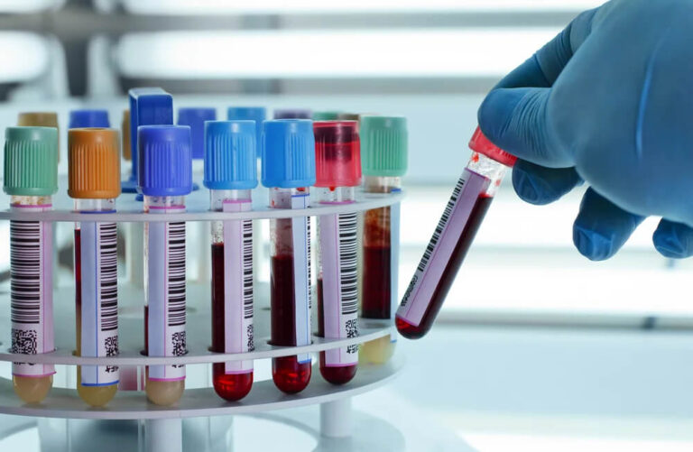 Lab Tests Same-Day Appointment | Singapore Diagnostics